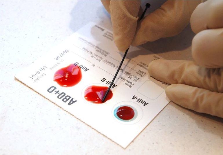 Rare and Rarest Blood Groups – learn-and-fly.co.in